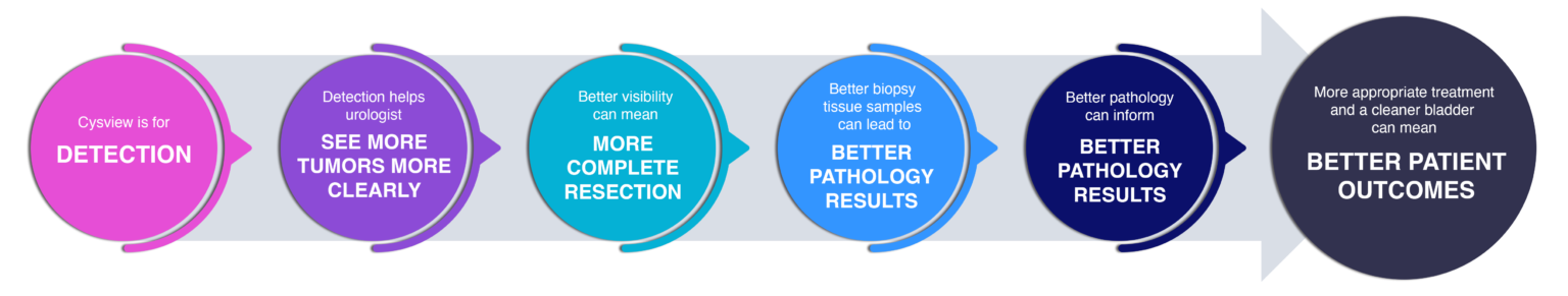 How to use Cysview for Blue Light Cystoscopy
